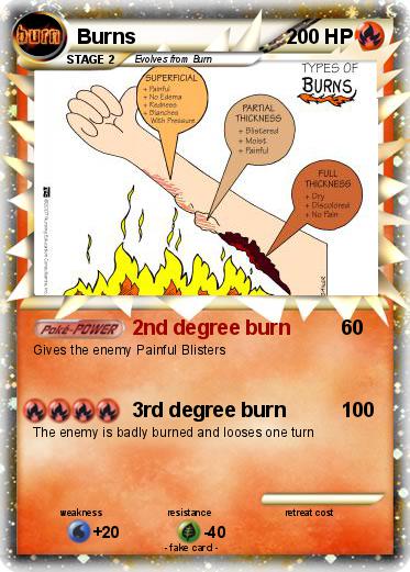 Pokémon Burns 10 10 - 2nd degree burn - My Pokemon Card